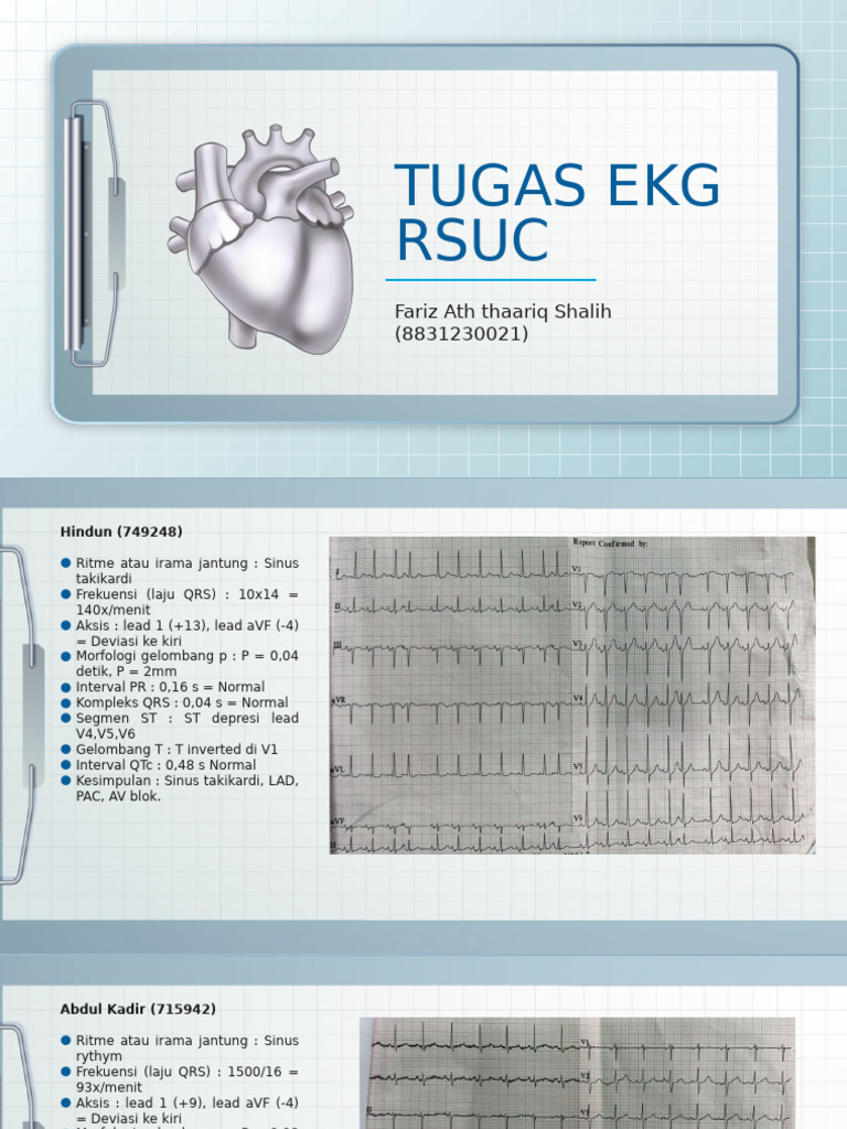 Tugas Ekg Rsuc | PDF | Electrocardiography | Thorax (Human Anatomy)