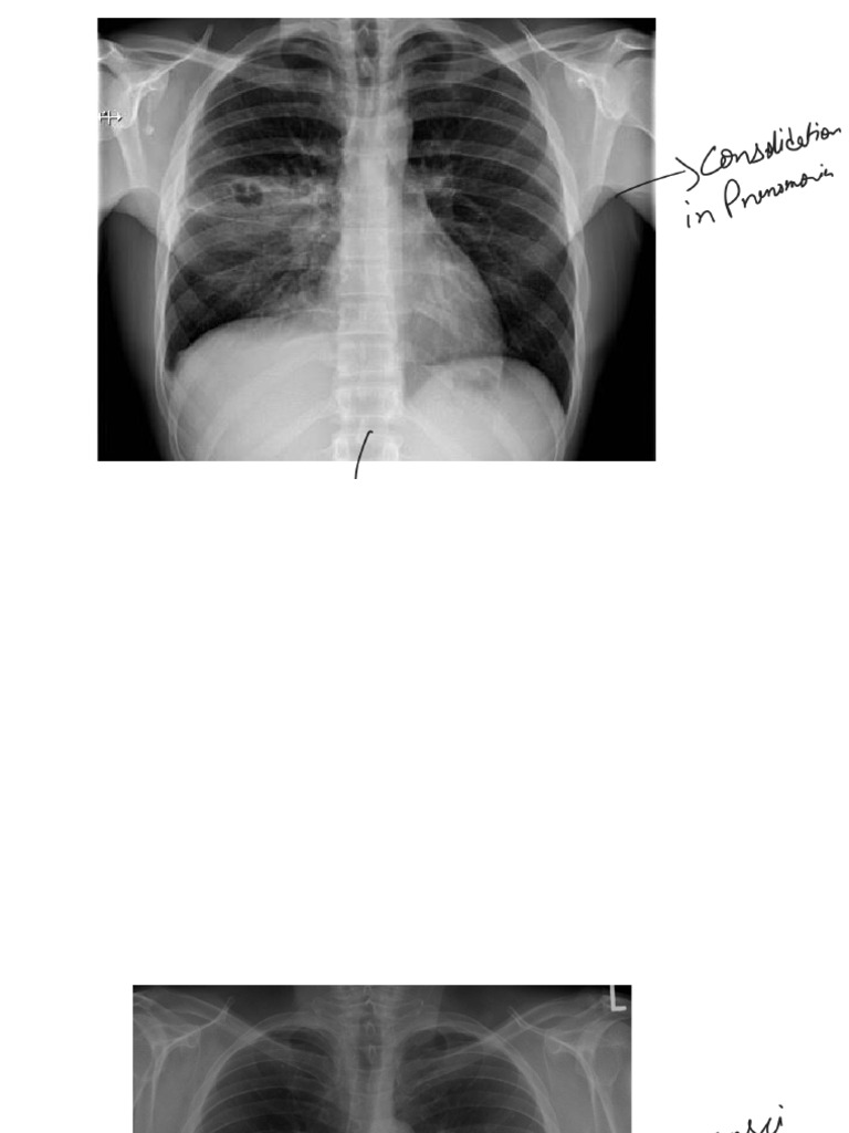 X RAYS ppt (1)-1_250214_124258 | PDF