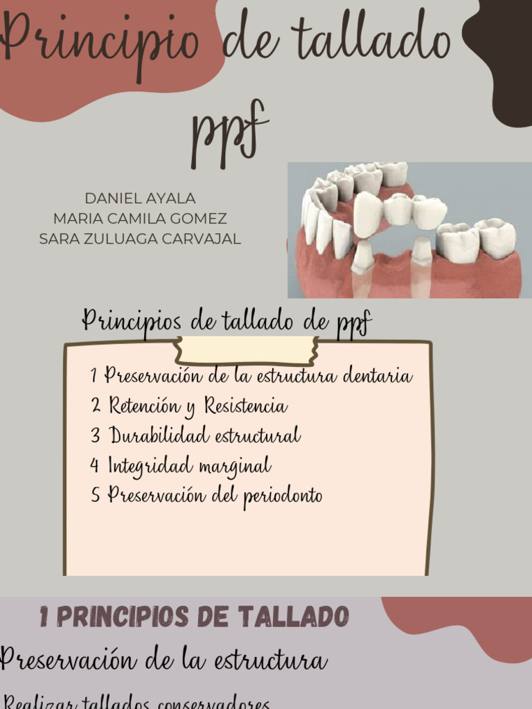 Protocolo de Tallado en Prótesis Fija | PDF