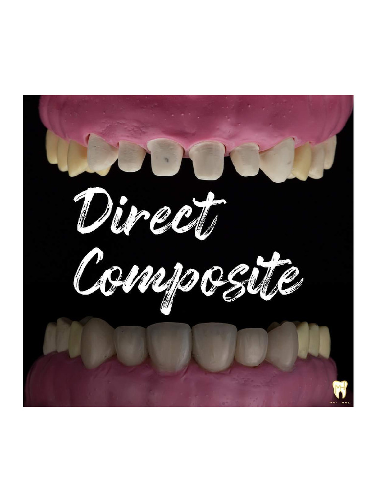 Direct Composite | PDF