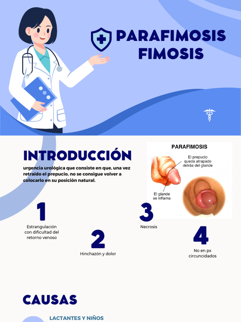 Parafimosis Fimosis | PDF