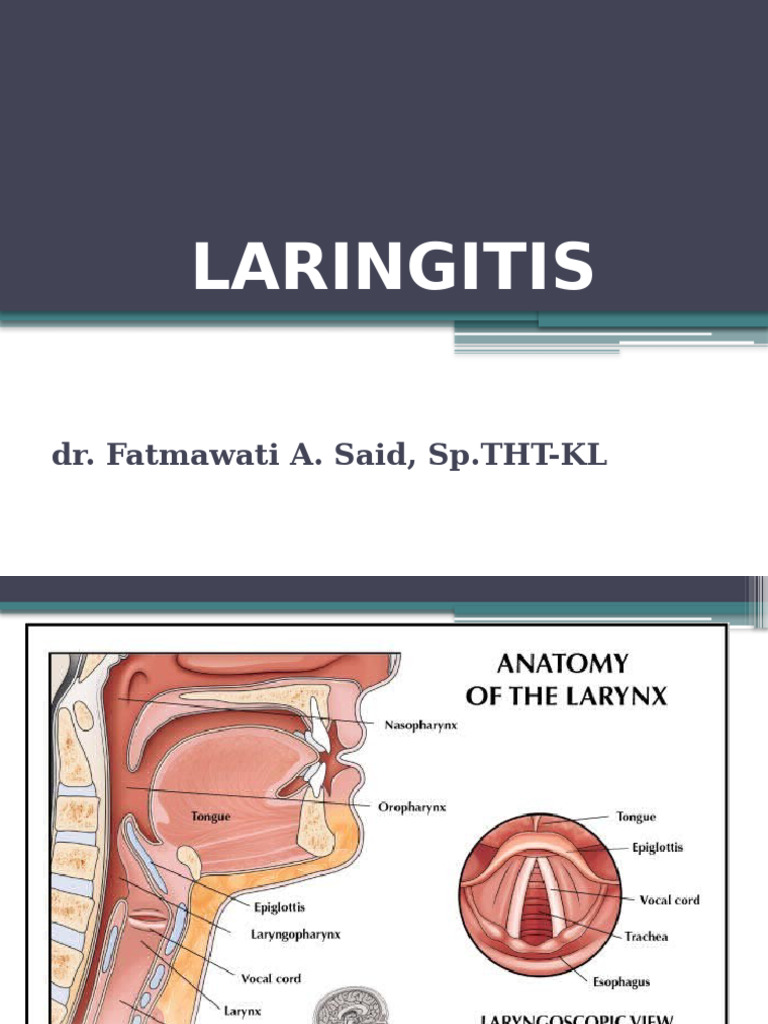 Laringitis | PDF