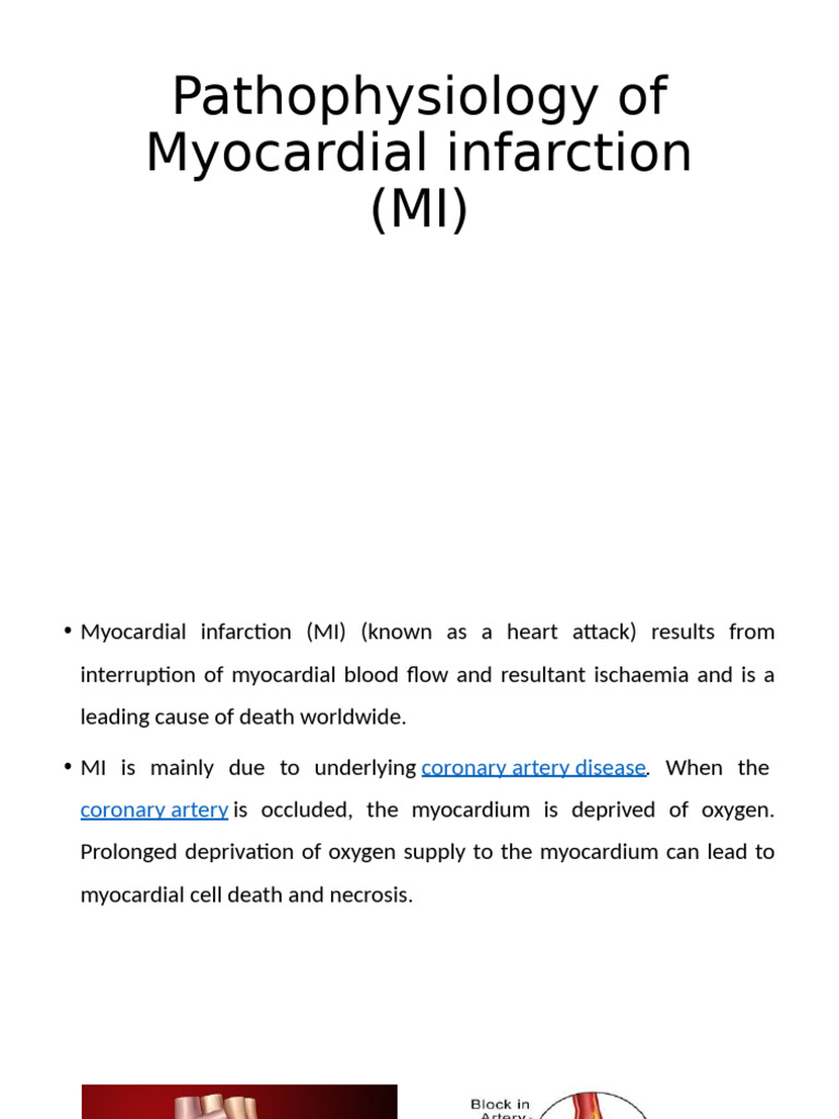 pathophysiology of MI | PDF | Myocardial Infarction | Physiology
