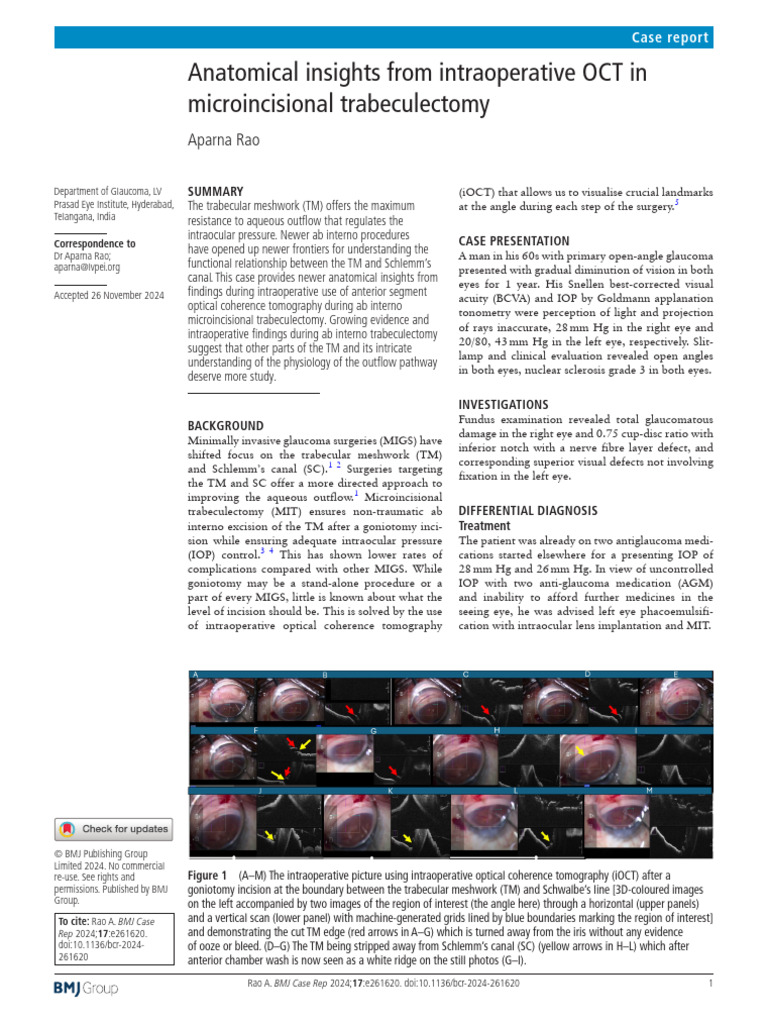 Intraoperative Oct in MIT | PDF | Glaucoma | Ophthalmology
