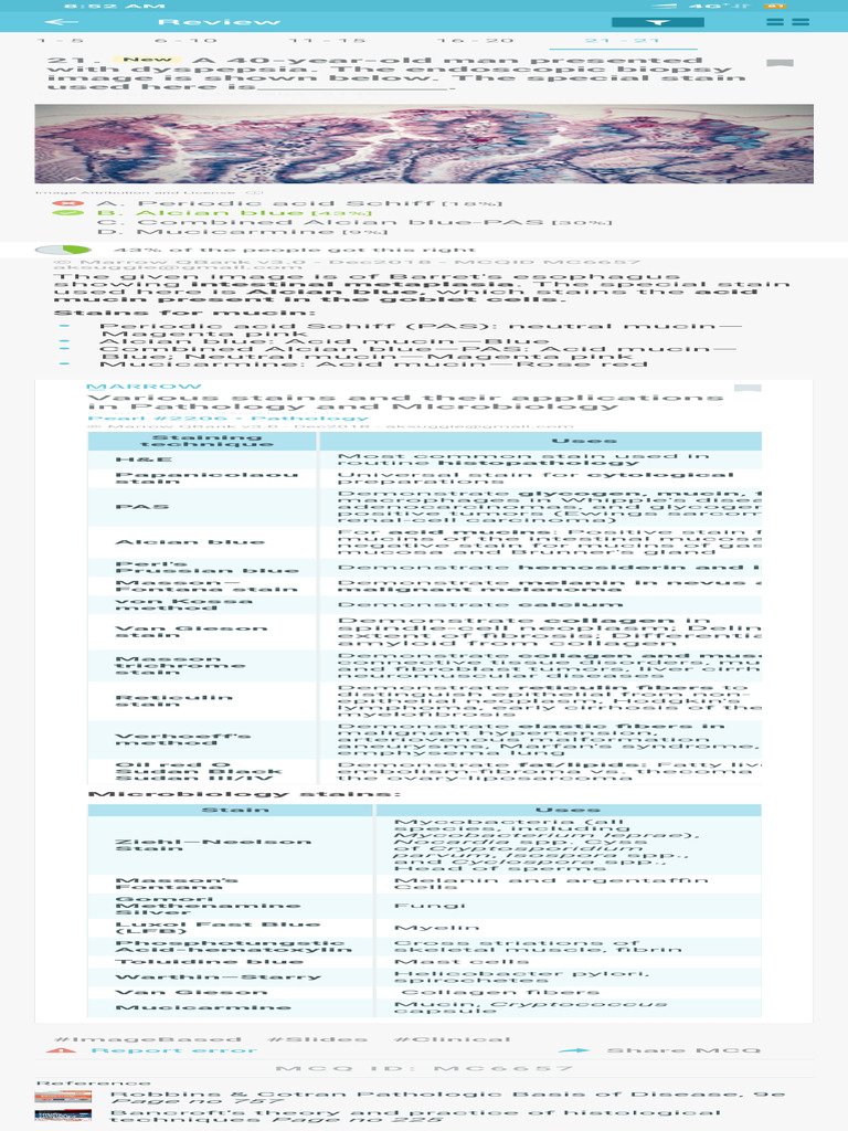 Pathology Marrow Qbank_262 | PDF