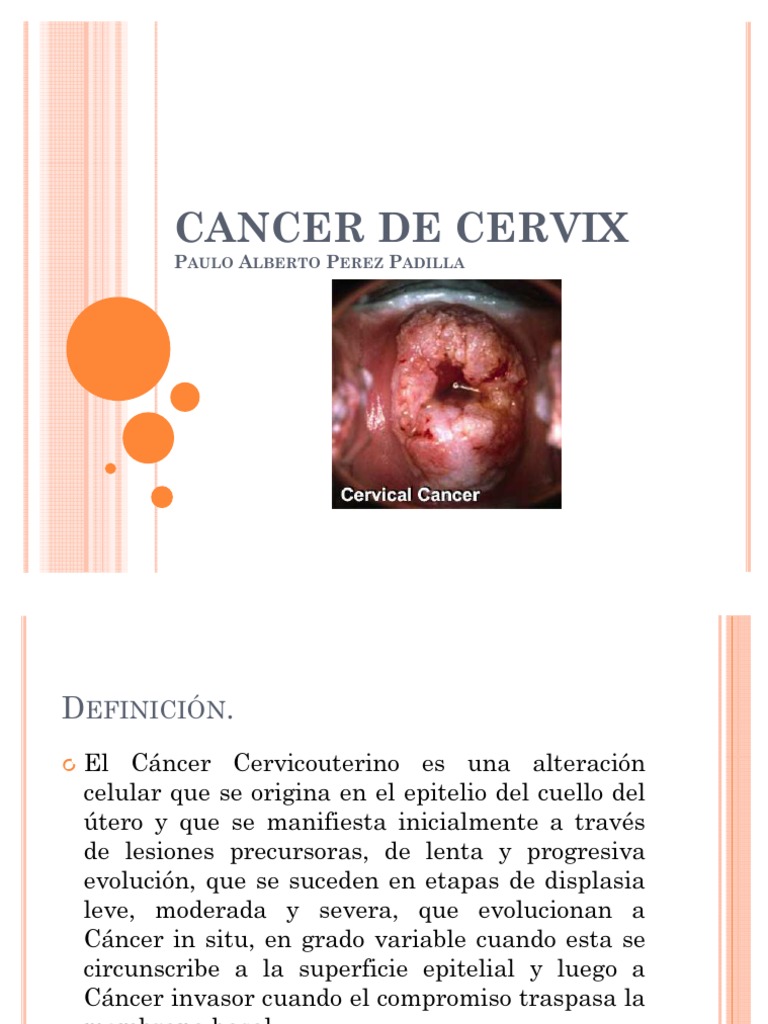 Cancer de Cervix | Cáncer de cuello uterino | Cáncer