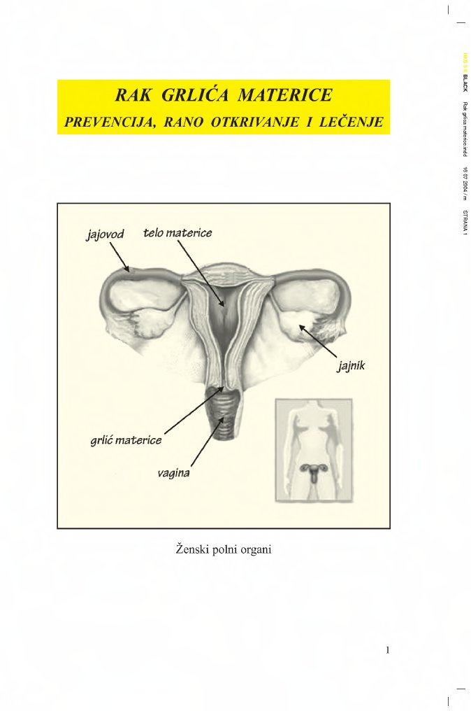 Rak Grlica Materice | PDF