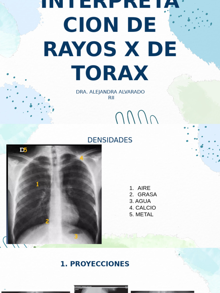 RX DE TORAX | PDF