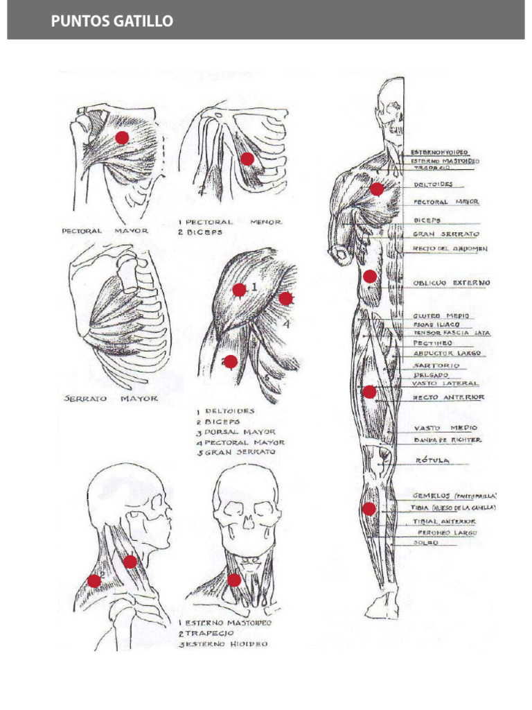 Puntos Gatillo Clase Prof Marcelo Manetti | PDF