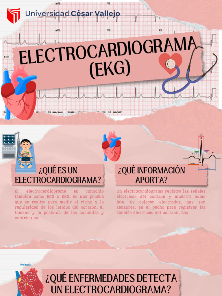 Guía Completa del Electrocardiograma | PDF