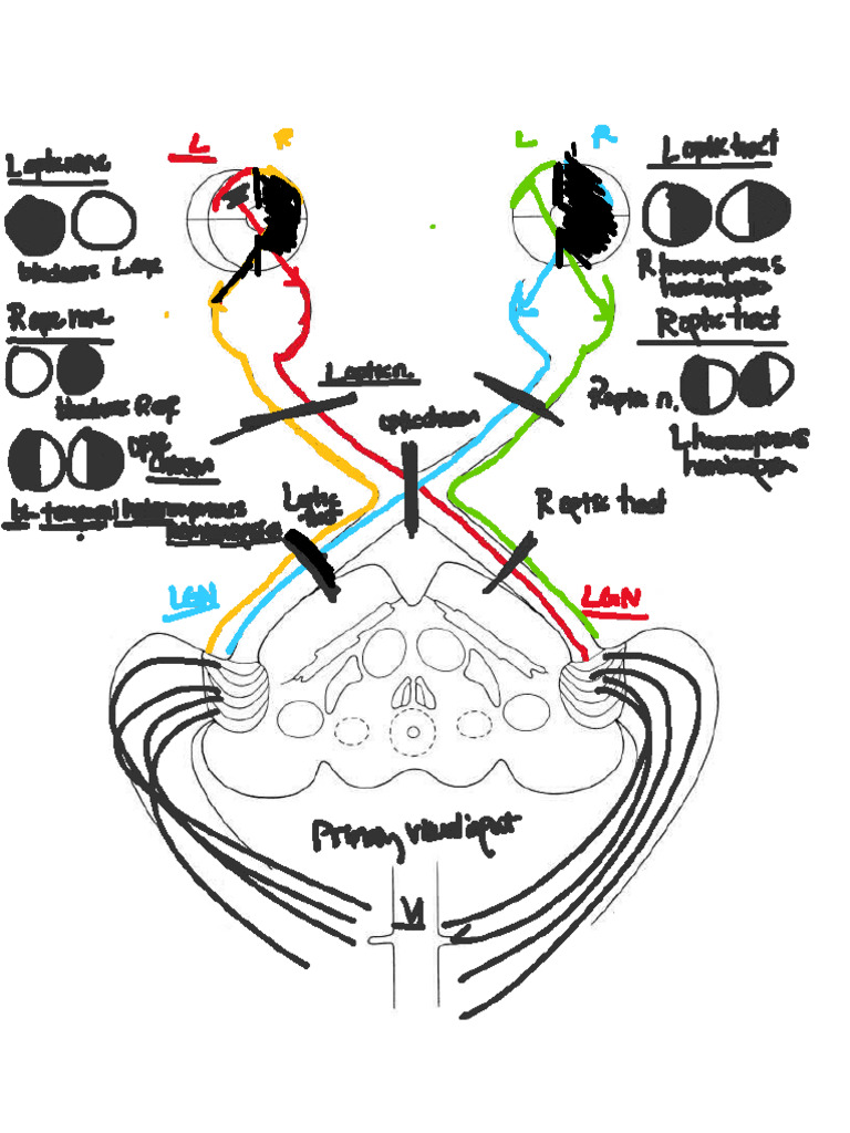Blank Visual Pathway Diagram_12.4 | PDF