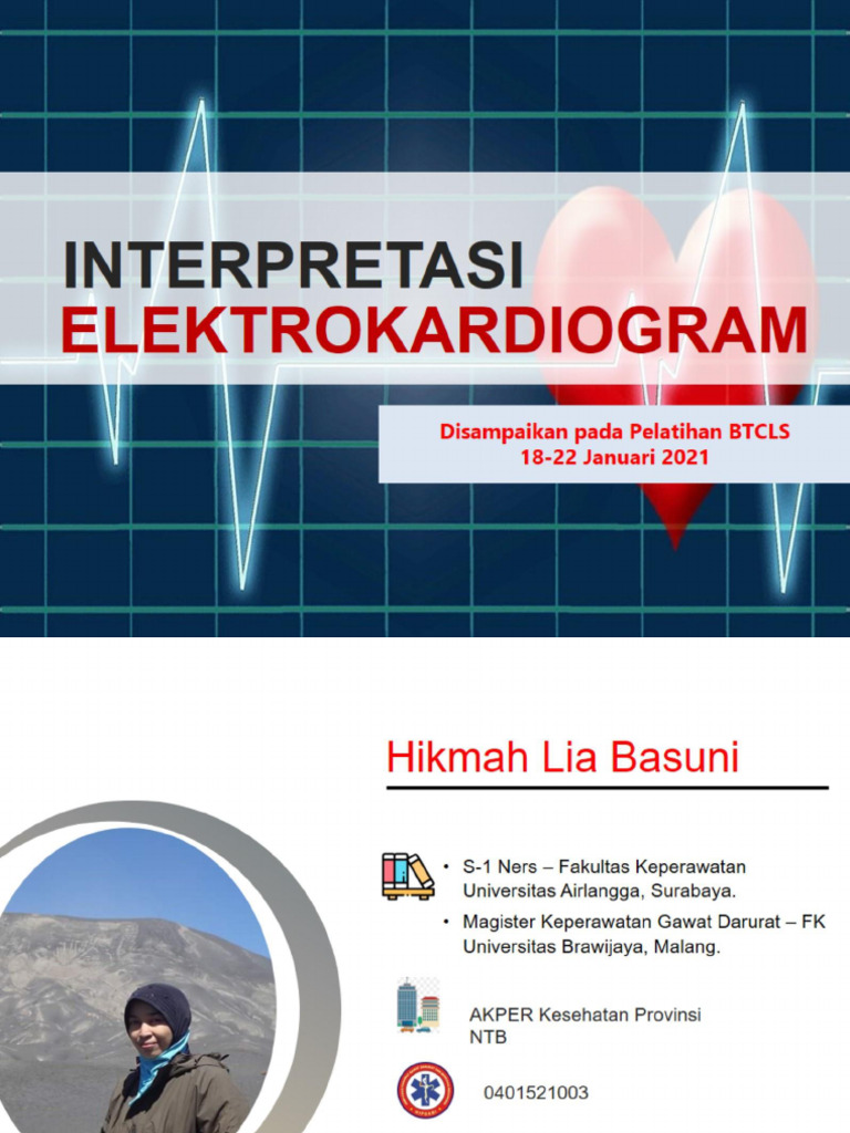 12. EKG | PDF
