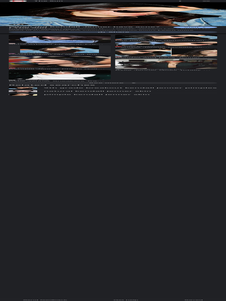 Kylie Breakout Kendall Jenner Pimples - Google Search | PDF