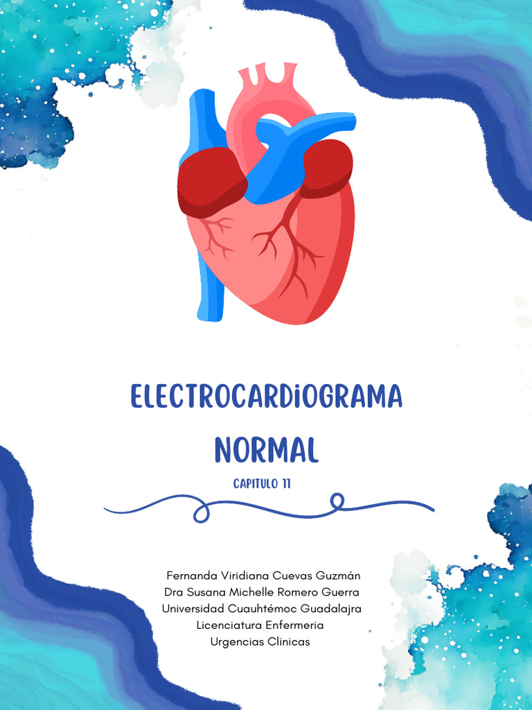 Electrocardiograma Normal y Sus Características | PDF | Corazón