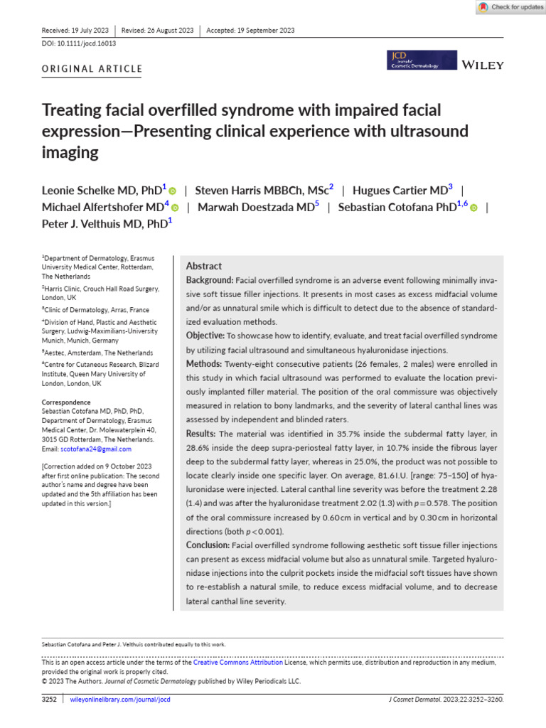 Treating Facial Overfilled Syndrome With Impaired Facial Expression ...
