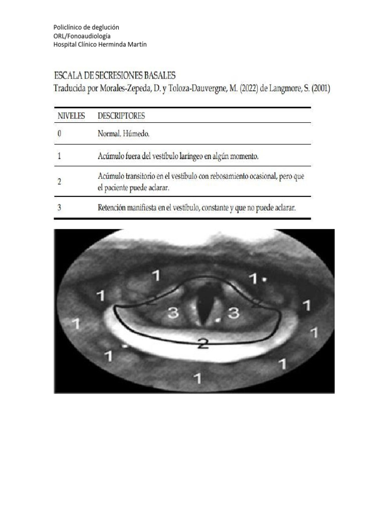 Escalas Objetivas Exs Objetivos de Deglución | PDF