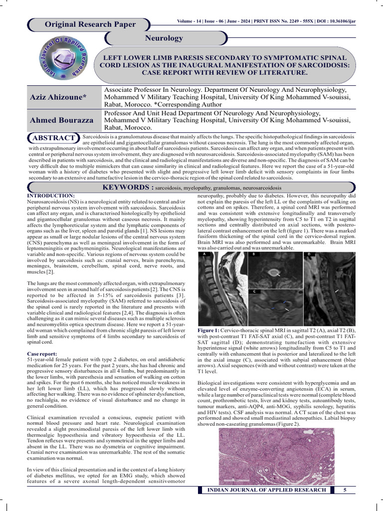 Left Lower Limb Paresis Secondary To Symptomatic S | PDF | Neurology ...