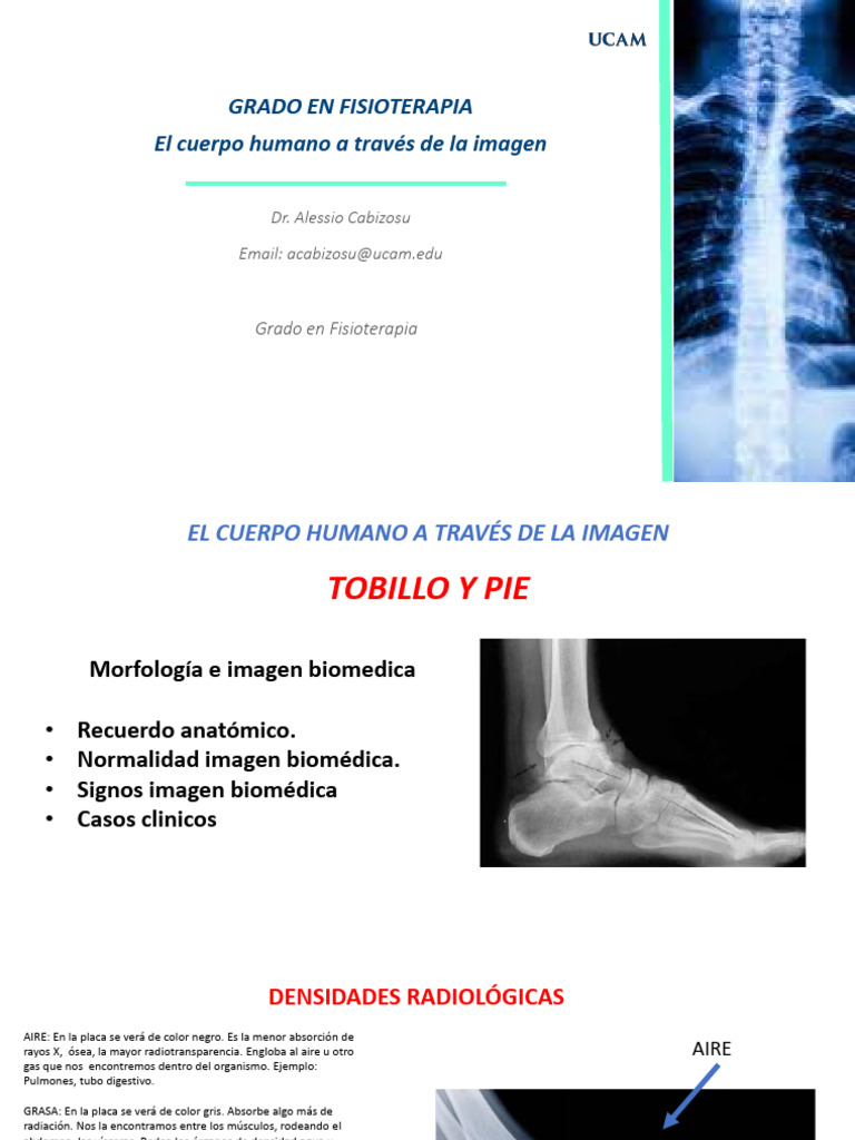 RX TOBILLO Y PIE | PDF | Tobillo | Sistema musculoesquelético