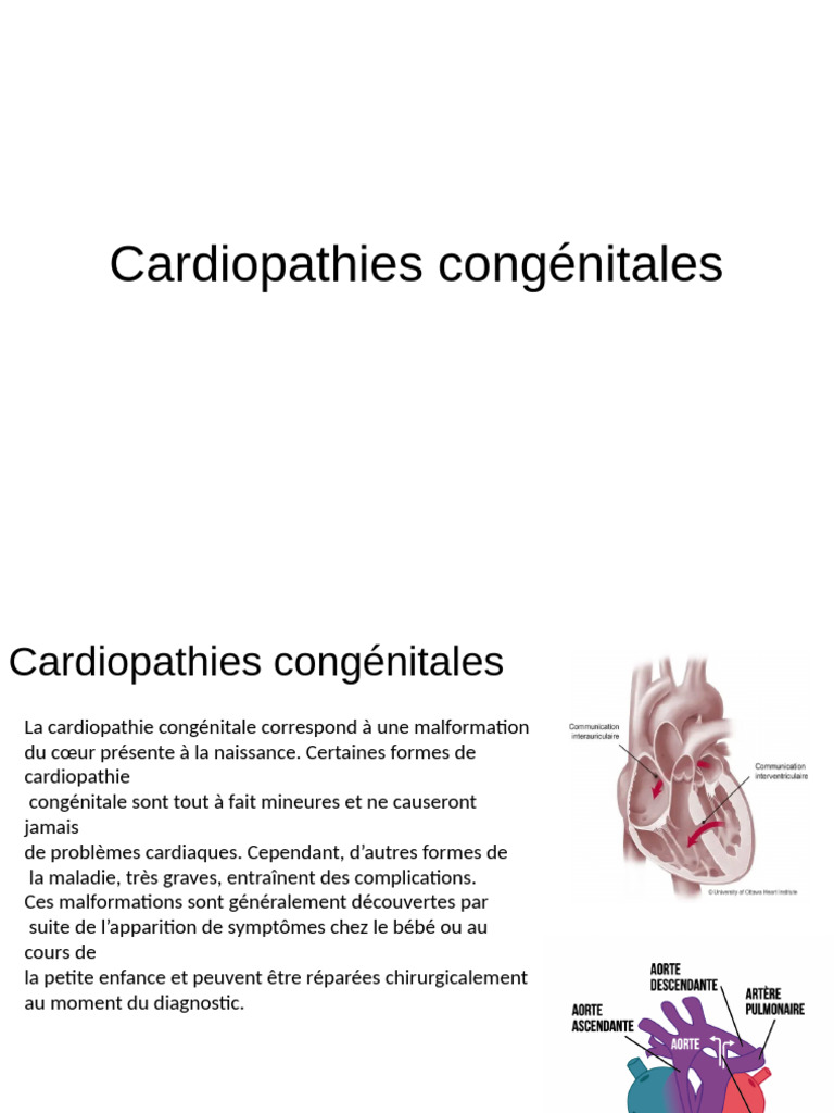 Cardiopathies congénitales (1) | PDF | Cardiopathie congénitale ...