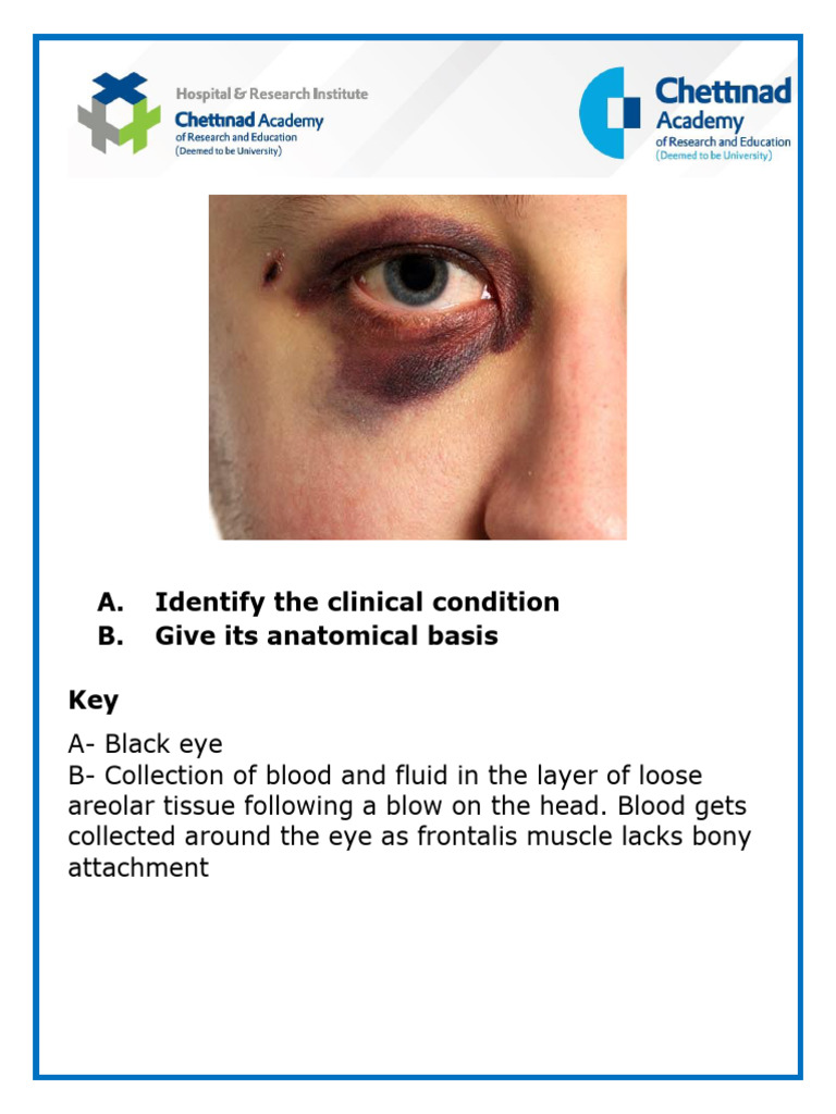 Head and Neck OSPE With Key | PDF