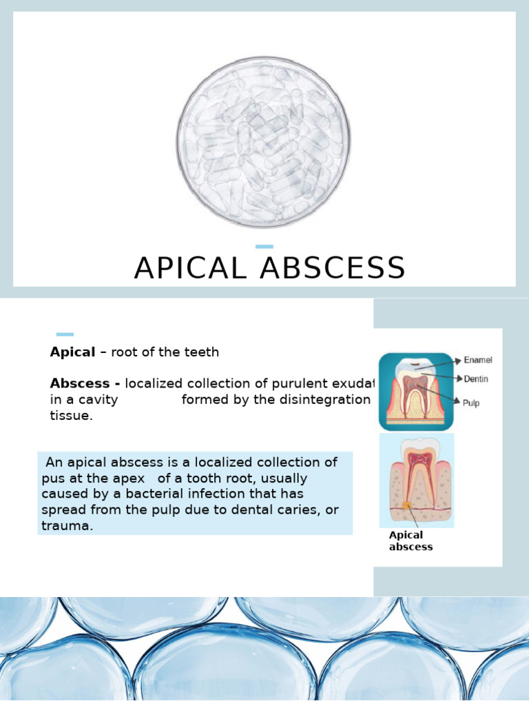 Apical Abscess | PDF | Human Tooth | Medical Specialties