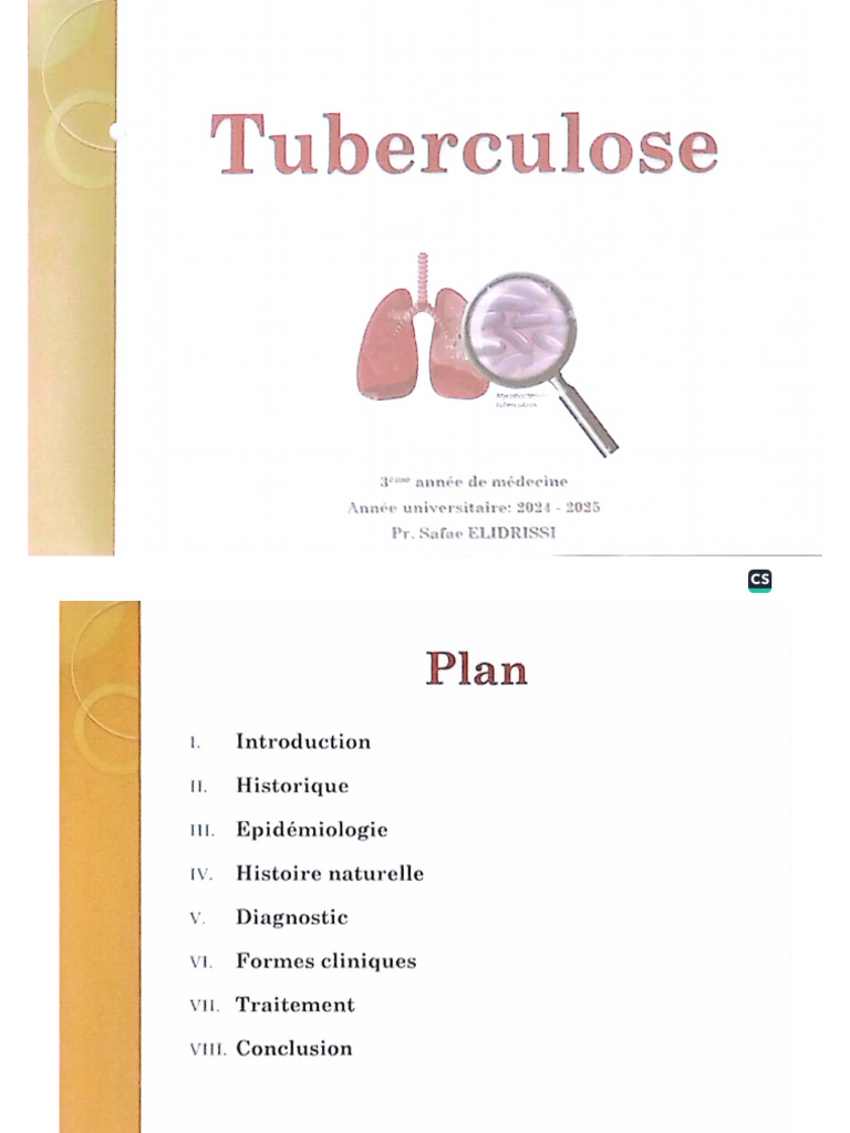 11. Tuberculose | PDF