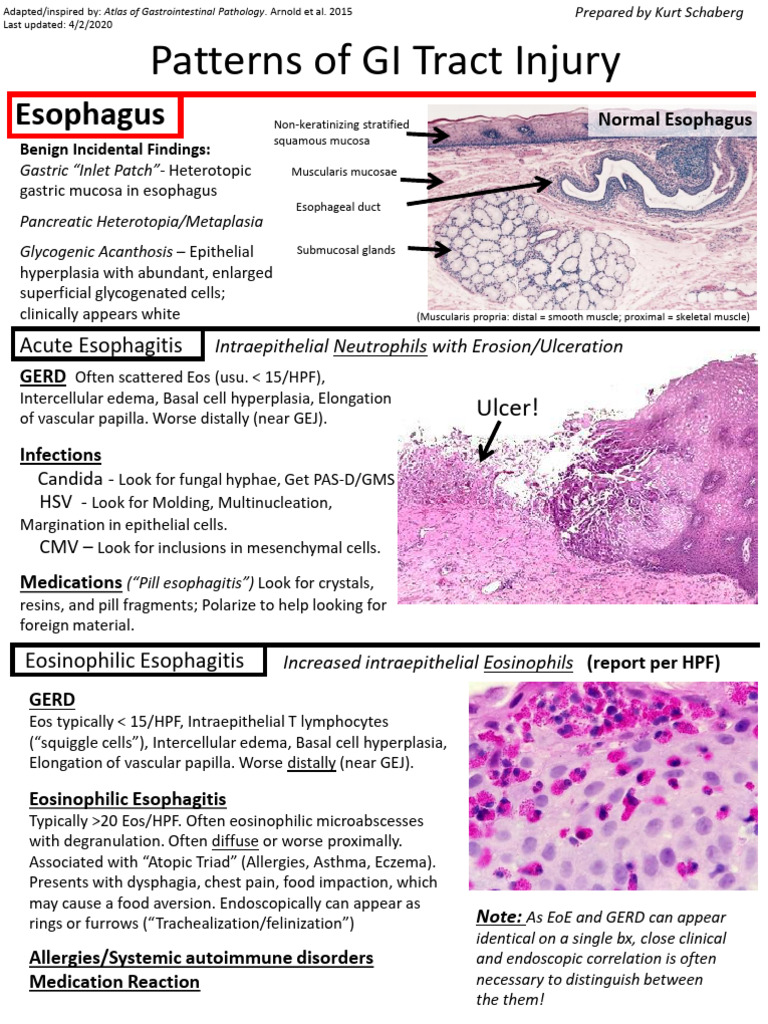 Inflammatory GIT Handout-3 | PDF | Crohn's Disease | Esophagus