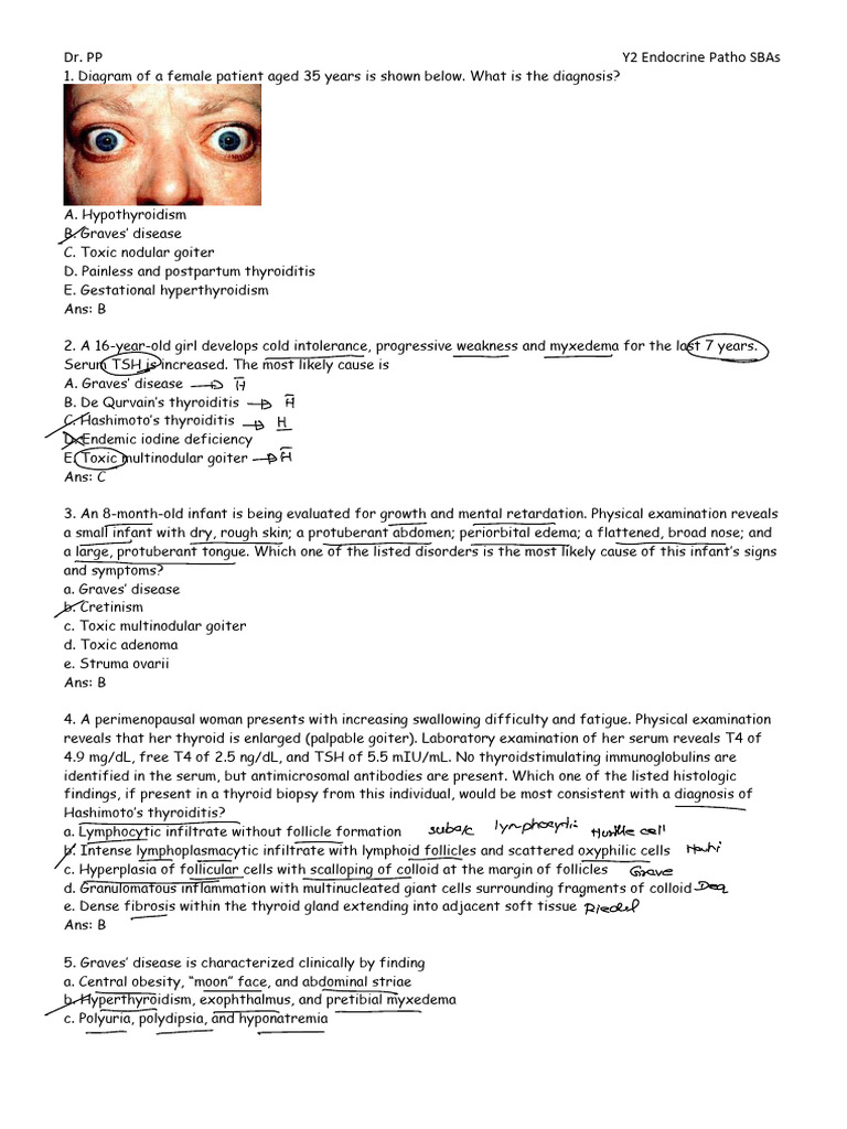 Y2 Endocrine Patho Sba 2 | PDF | Thyroid | Hyperthyroidism