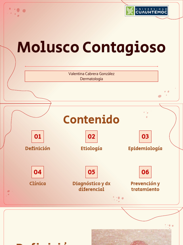 Guía de Molusco Contagioso | PDF | Medicina CLINICA | Virus