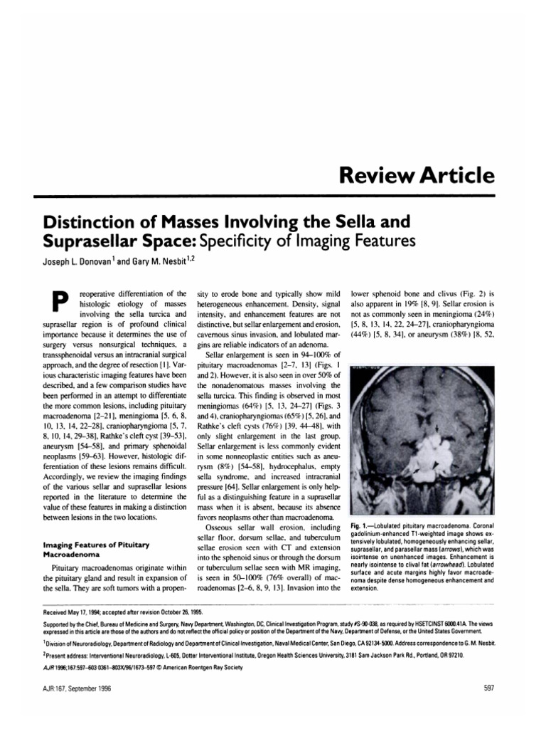 Donovan Nesbit 2013 Distinction of Masses Involving the Sella and ...