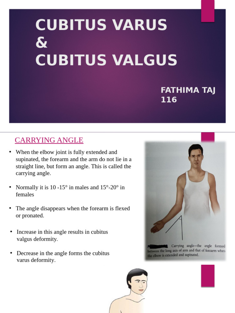 Cubitus Varus & Valgus Final | PDF | Elbow | Musculoskeletal System