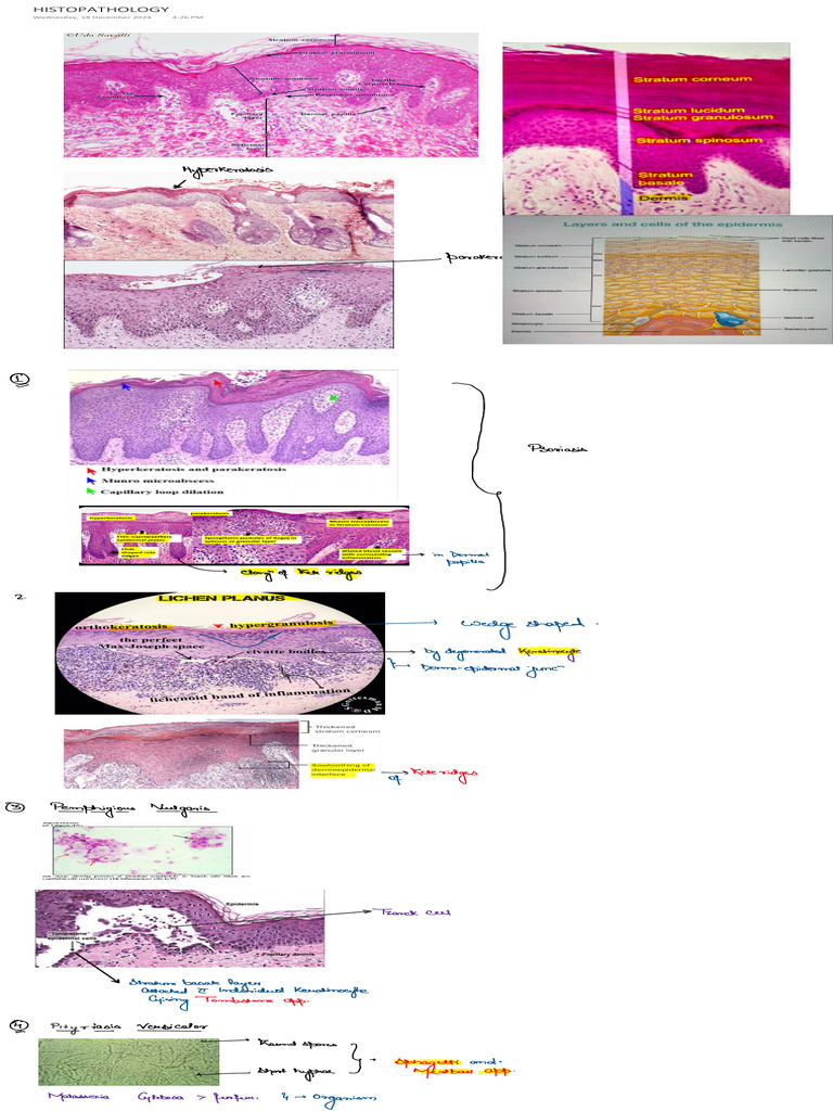 HISTOPATHOLOGY | PDF