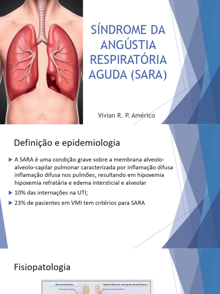 S Ndrome Da Ang Stia Respirat Ria Aguda Sara | PDF