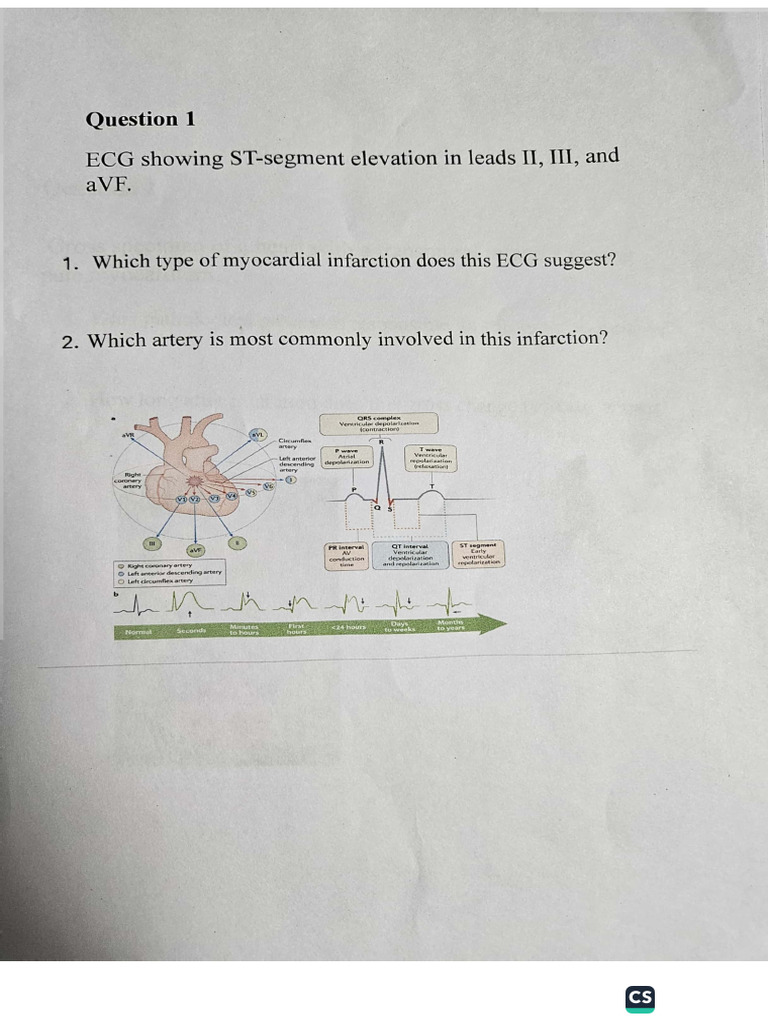Cardiomyopathy SPOTTERS | PDF