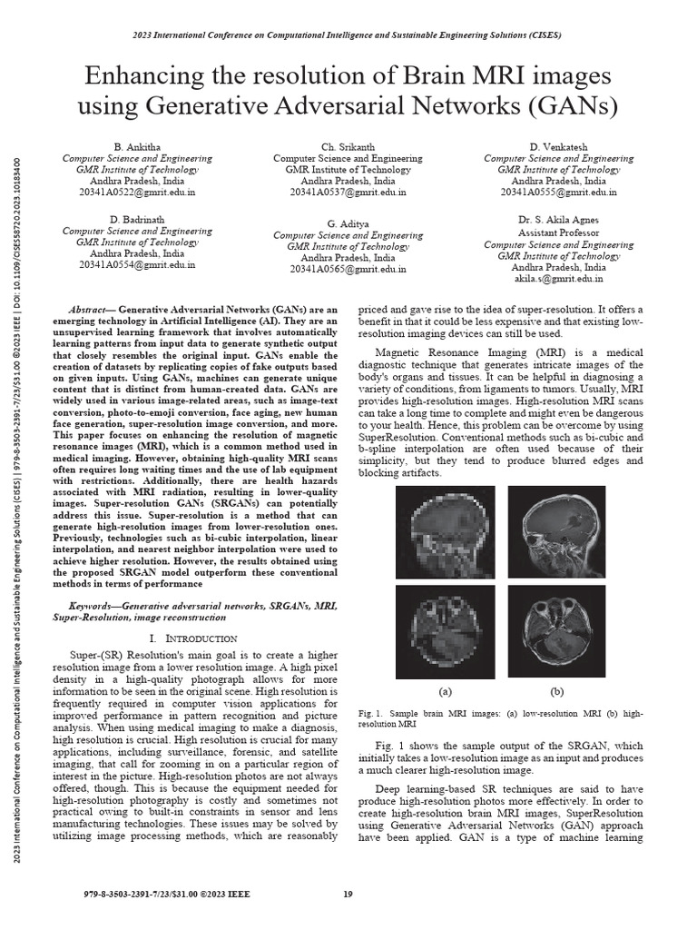 Enhancing The Resolution of Brain MRI Images Using Generative ...