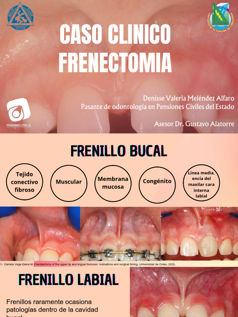 Pink Yellow Blobs Basic Simple Presentation - PDF - Compressed | PDF ...