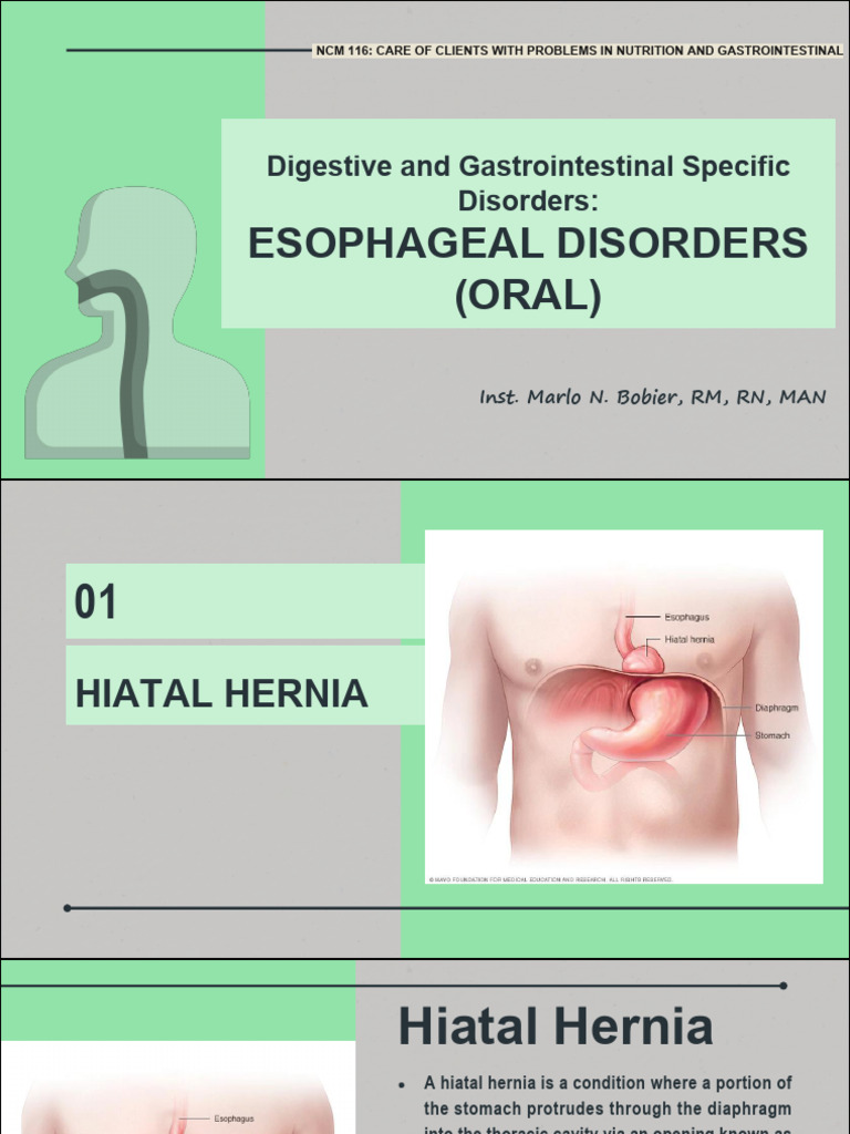II. Esophageal (Oral) Disorders | PDF | Gastroesophageal Reflux Disease | Esophagus