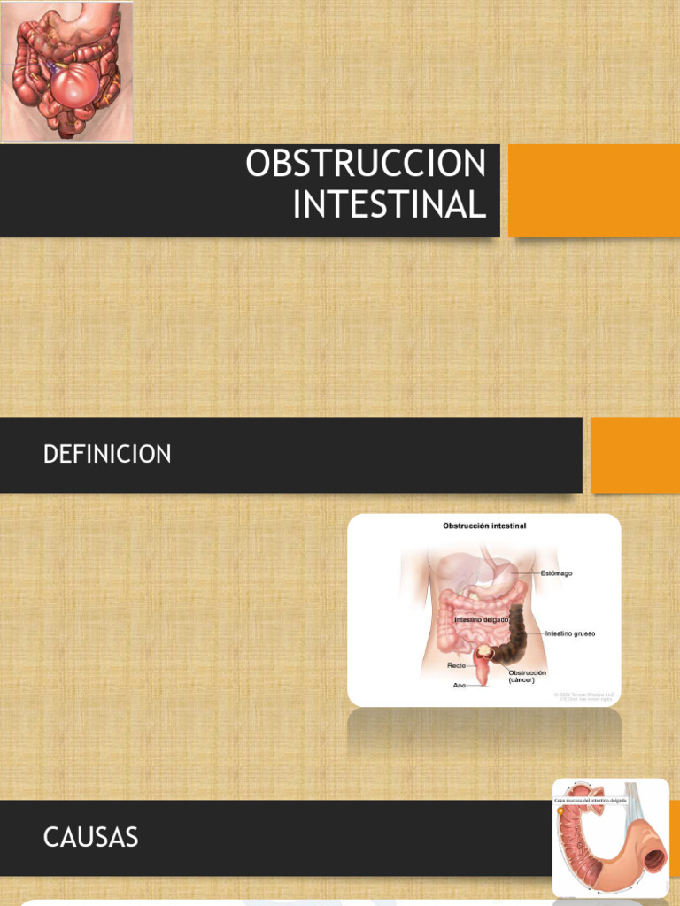 Obstruccion Intestinal | PDF | Especialidades Medicas | Sistema digestivo