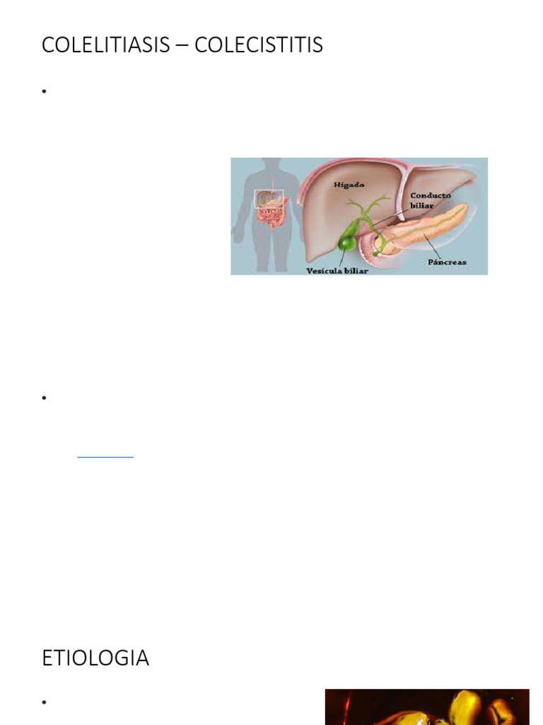 Colelitiasis y Colecistitis: Causas y Síntomas | PDF | Vesícula biliar ...
