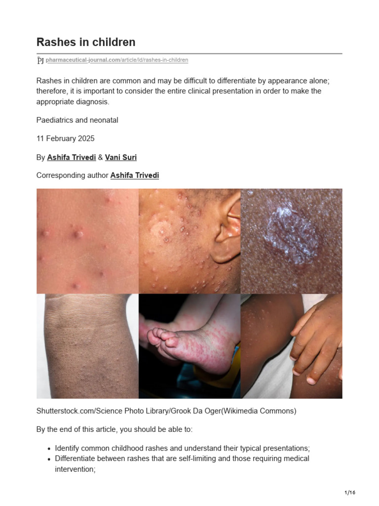 Pediatric Rash Diagnosis Guide | PDF | Dermatitis | Medicine