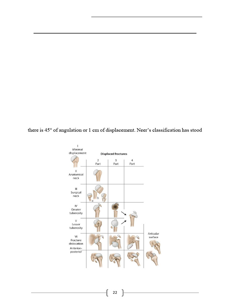 9-Classification and Mechanism of Injury | PDF | Shoulder | Joints