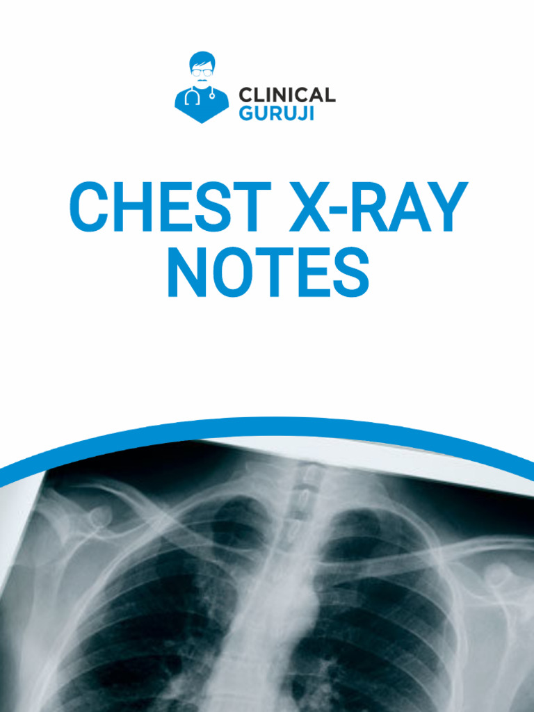 Chest X-Ray Interpretation Guide | PDF | Heart | Respiratory Tract