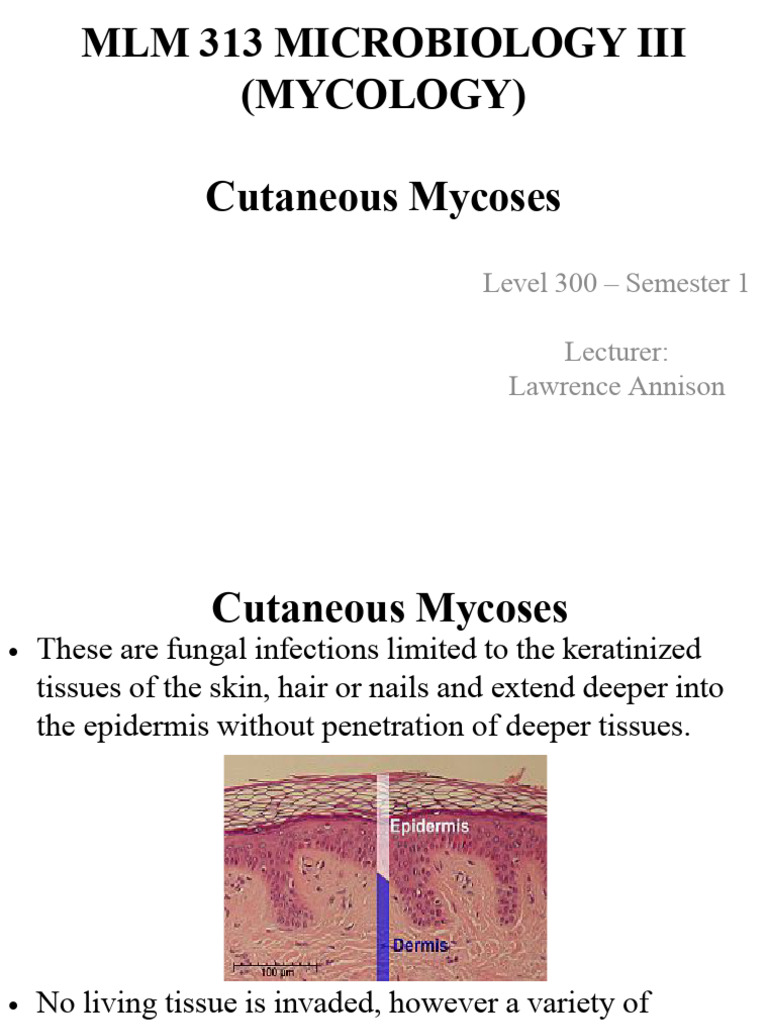 Understanding Cutaneous Mycoses: Tinea Infections | PDF | Mycology | Fungus