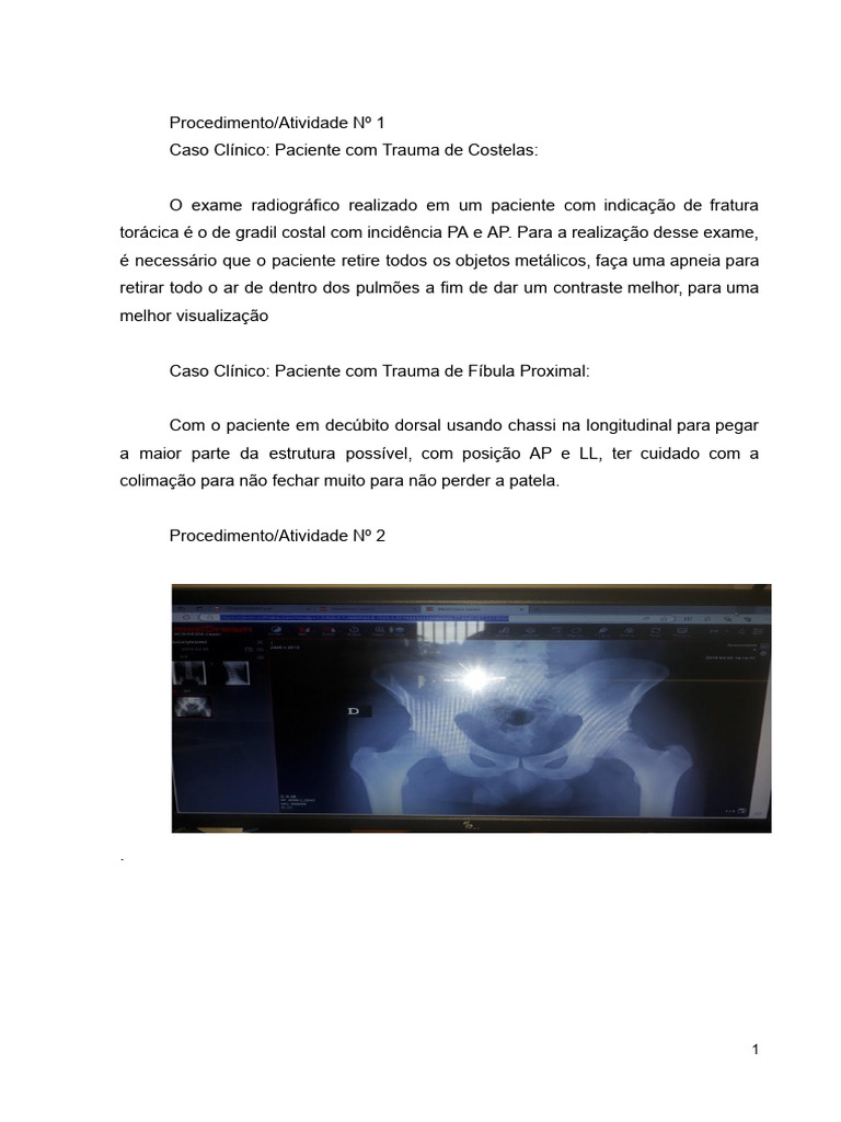 Atividade de Aula Pratica | PDF