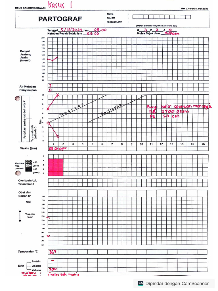 Partograf Kasus 1 | PDF