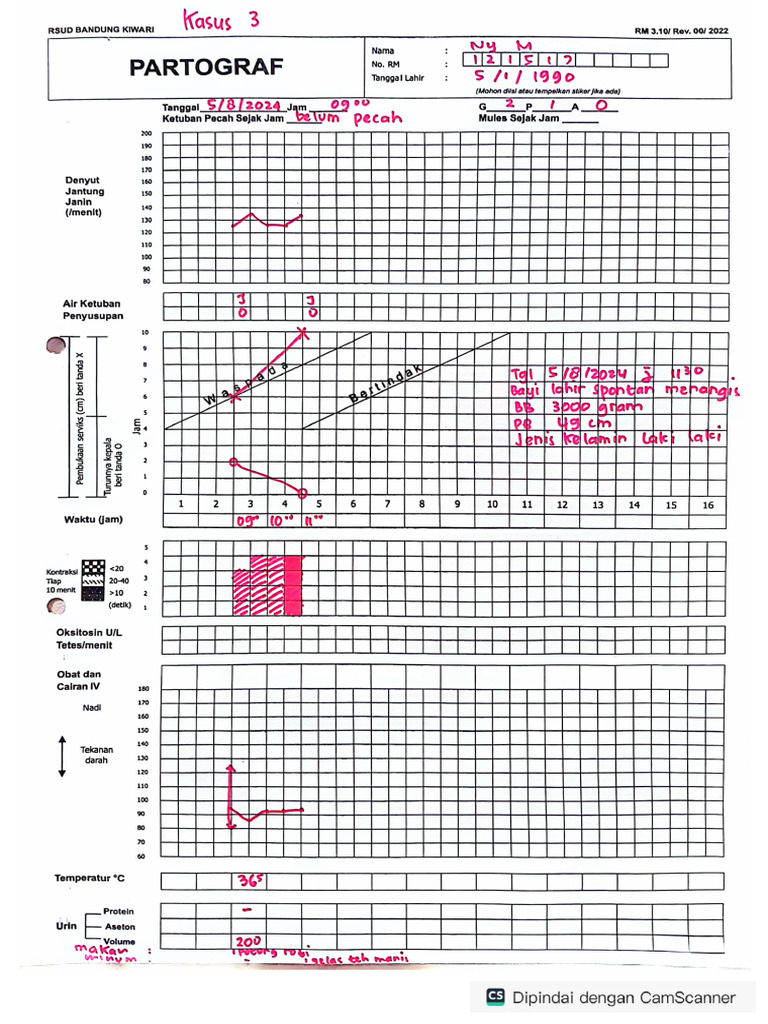 partograf kasus 2 NY M | PDF