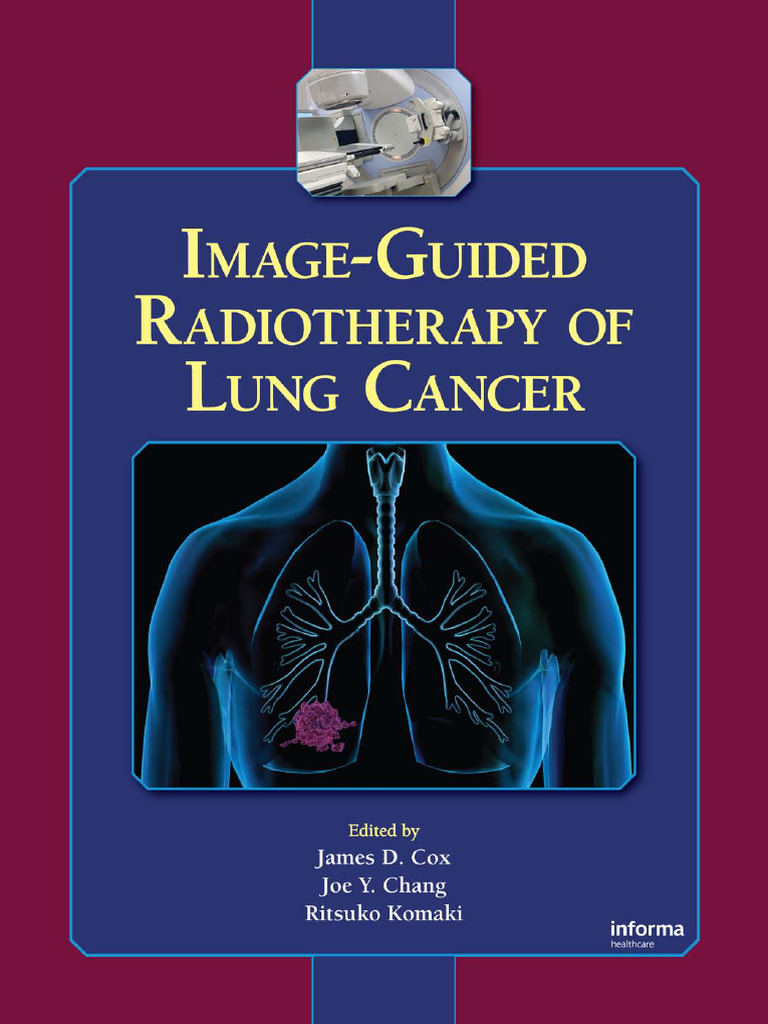 Image Guide Radiotherapy of Lung Cancer | PDF | Radiation Therapy ...