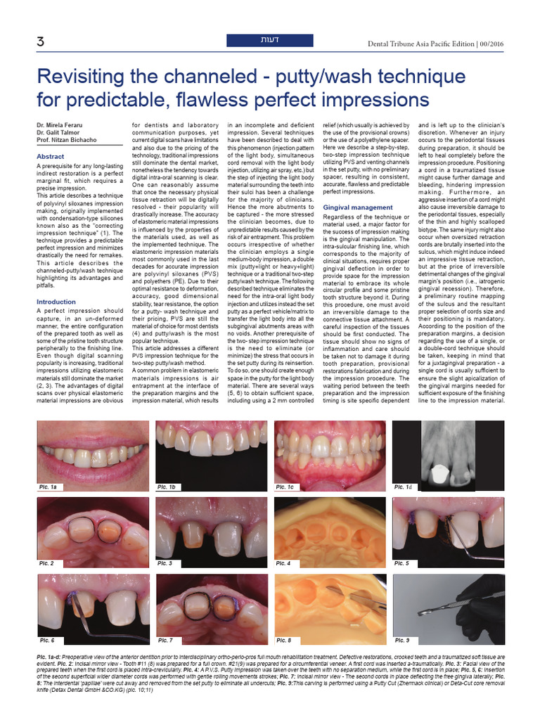 Revisiting The Channeled Putty Wash Tech | PDF | Dentistry Branches | Mouth