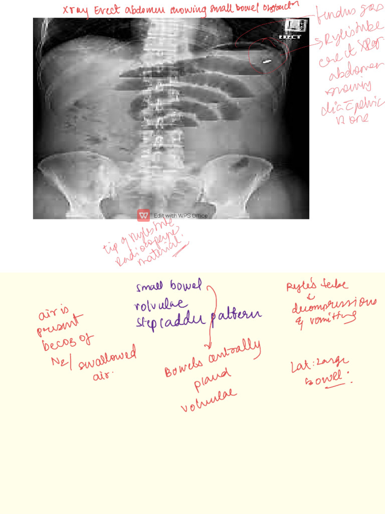 Final X Rays PDF | PDF