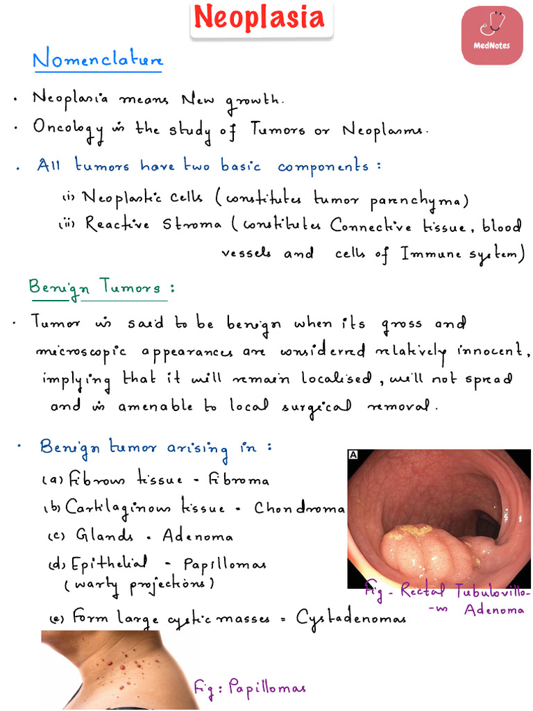 Introduction of Neoplasia | PDF | Neoplasms | Adenoma